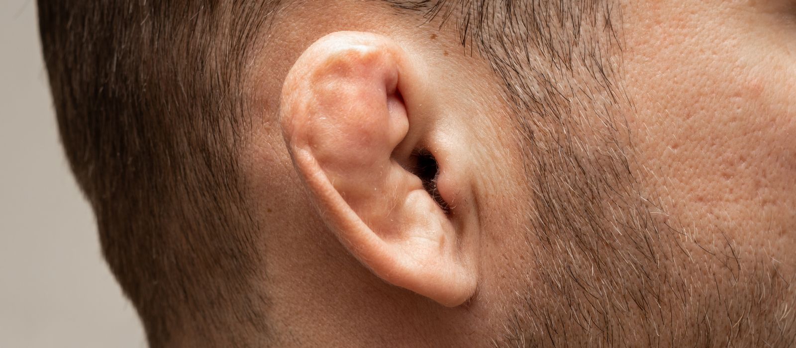 Bloemkooloren in vechtsporten, wat zijn dat? – Combat Arena